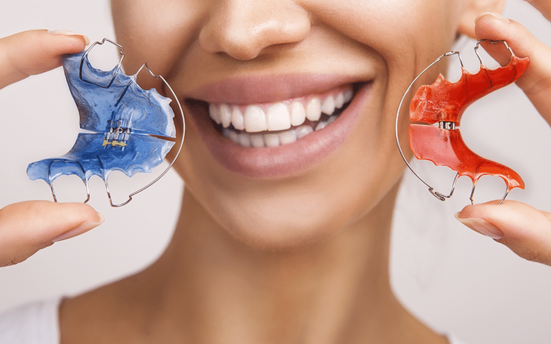 Retention After Braces: Hold That Perfect Smile